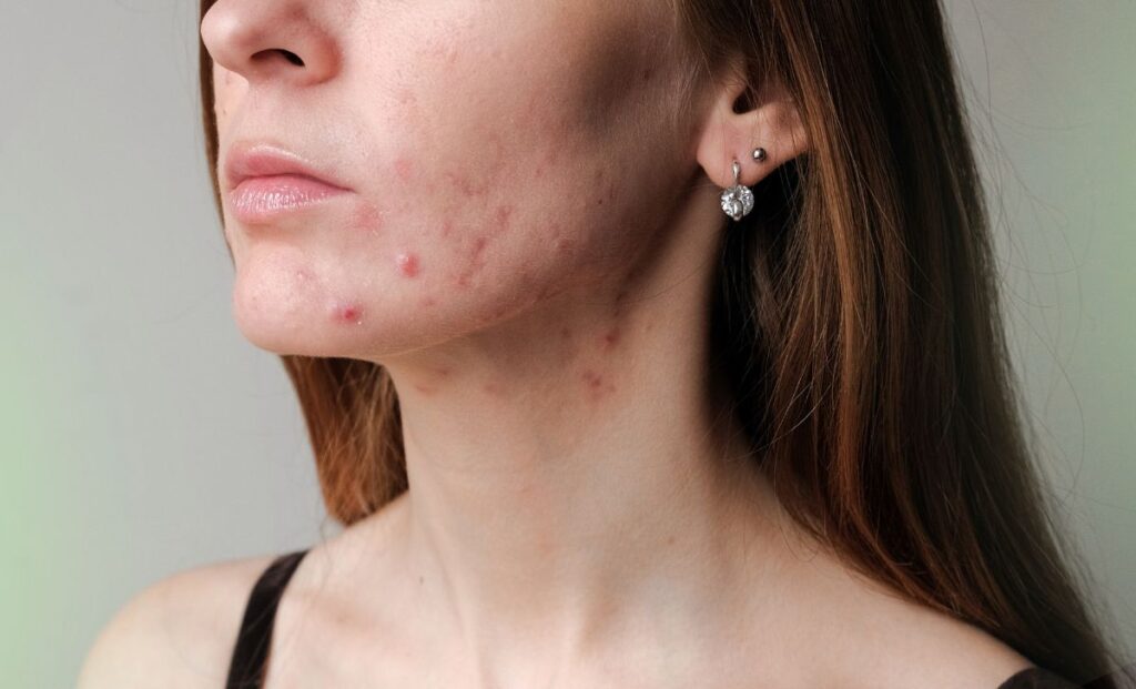 A Deep Dive into Your Skin Layers and the Benefits of the Redox Facial ...